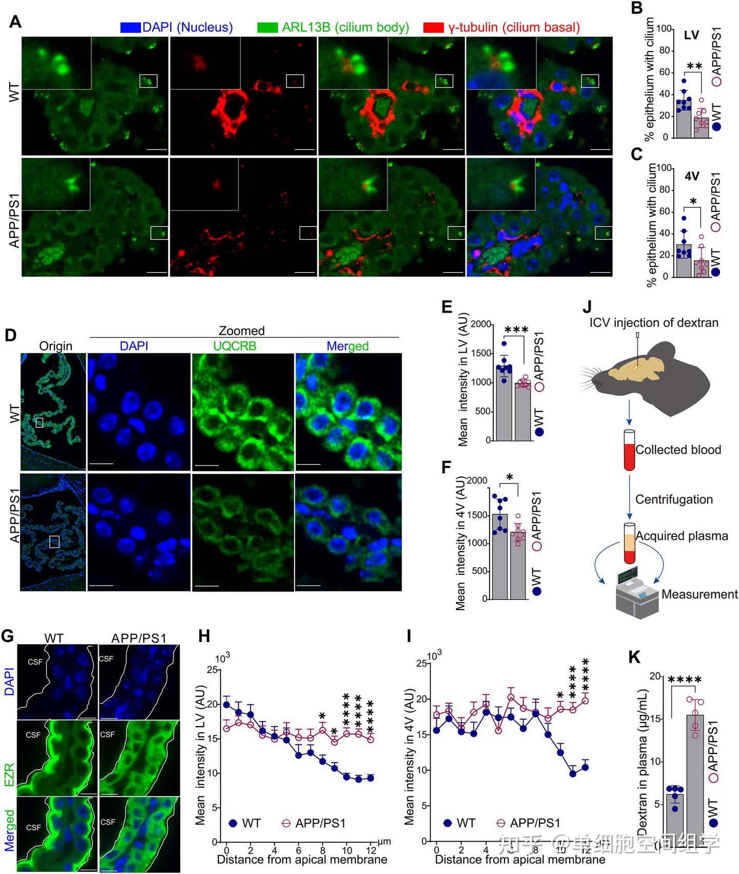 从亚细胞到组织层面：TissueGnostics 发现脉络丛上皮细胞损伤激活 AD 巨噬细胞极化的新通路 - 知乎