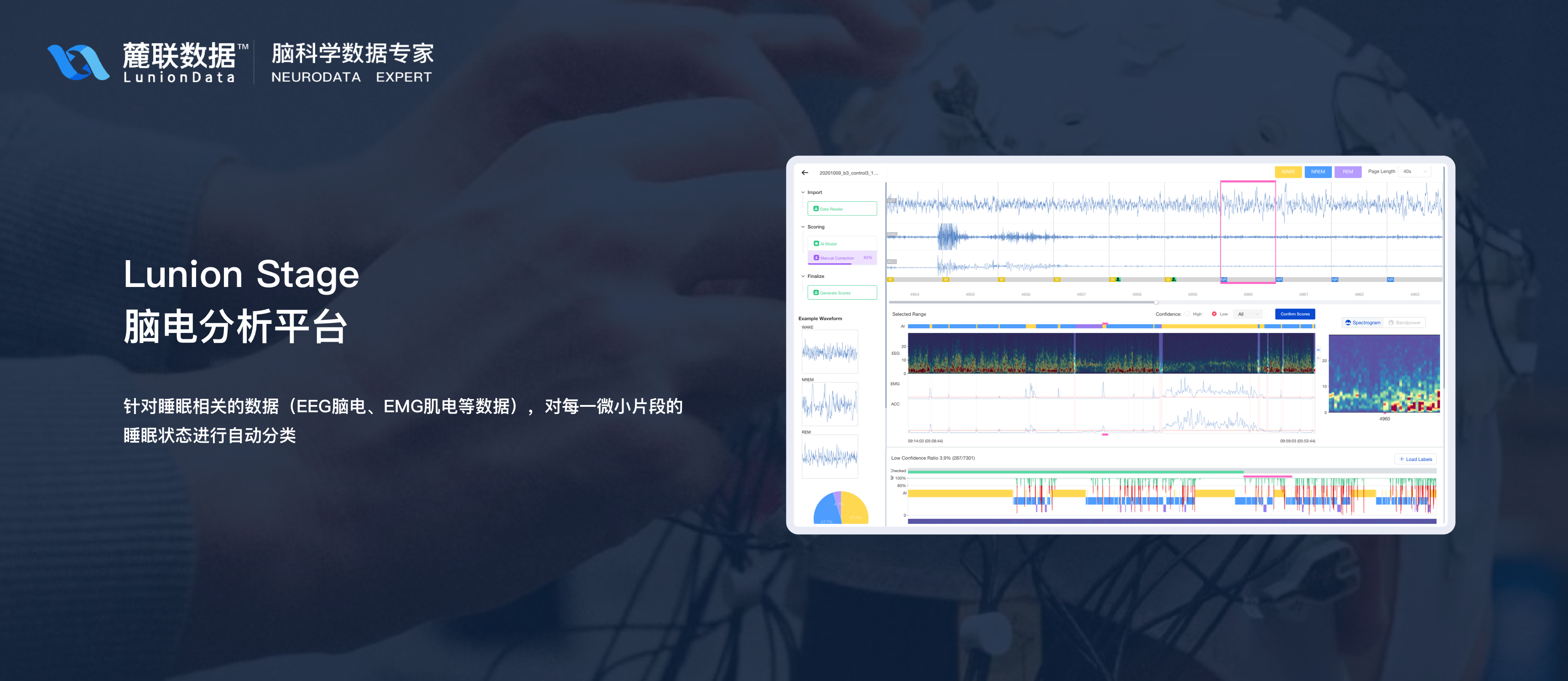 睡眠分期 | Lunion Stage 脑电分析平台 - 知乎