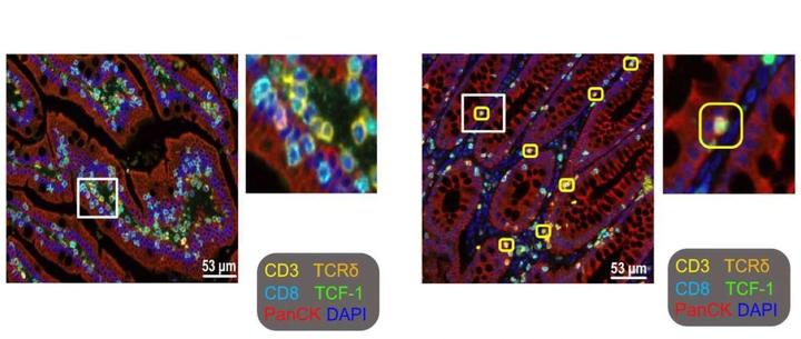 Sci Immunol | 流式细胞术+单细胞测序+多重荧光免疫组化多组学联用发现上皮内淋巴细胞（IEL）抗肿瘤反应潜在靶点 - 知乎