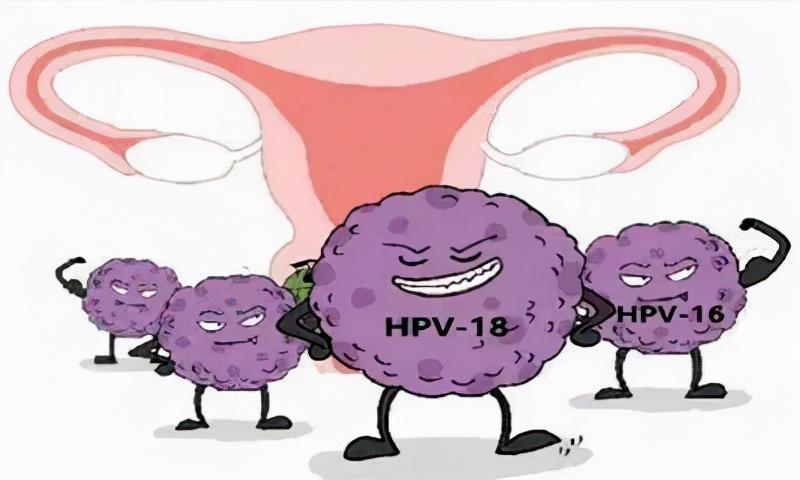 感染HPV就会得宫颈癌？关于HPV，你必须要知道的5件事 - 知乎