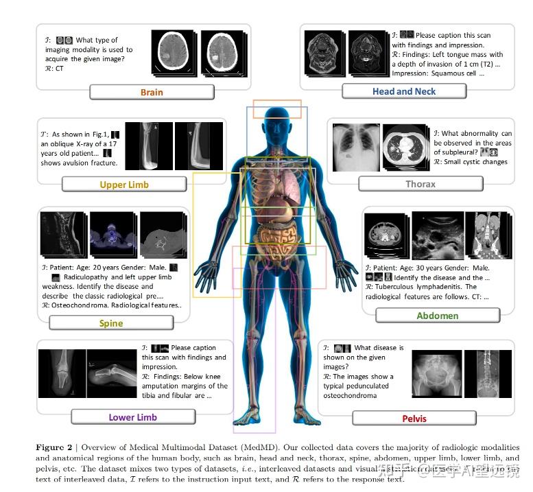 交大发布RadFM：全球首个放射科通用大模型 ，同时处理2D/3D医学图像，性能超越GPT-4V - 知乎