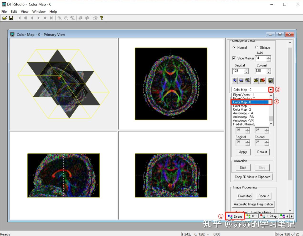 Diffusion spectrum imaging (DSI) 扩散光谱成像 与 Diffision tensor imaging （DTI ...