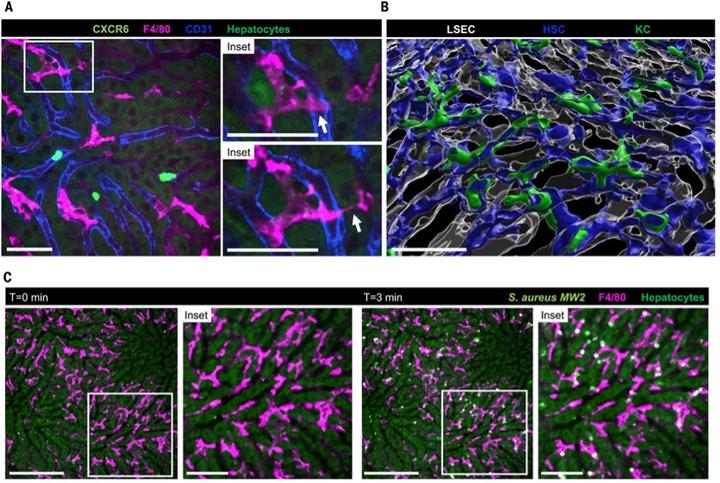 Science ｜ 肝脏的自救：Kuffer合胞体在纤维化肝脏中补充巨噬细胞功能 - 知乎