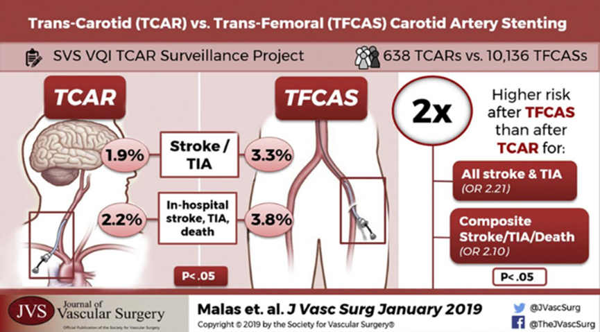 经颈动脉血运重建（TCAR）治疗的研究进展 - 知乎