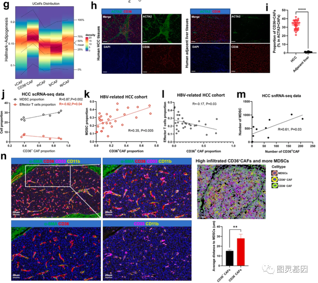 Cell Discov ｜ CD36+癌细胞抑制巨噬细胞迁移为肝癌提供免疫抑制微环境 - 知乎