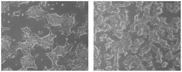 LNCaP clone FGC细胞培养攻略详解！ - 知乎