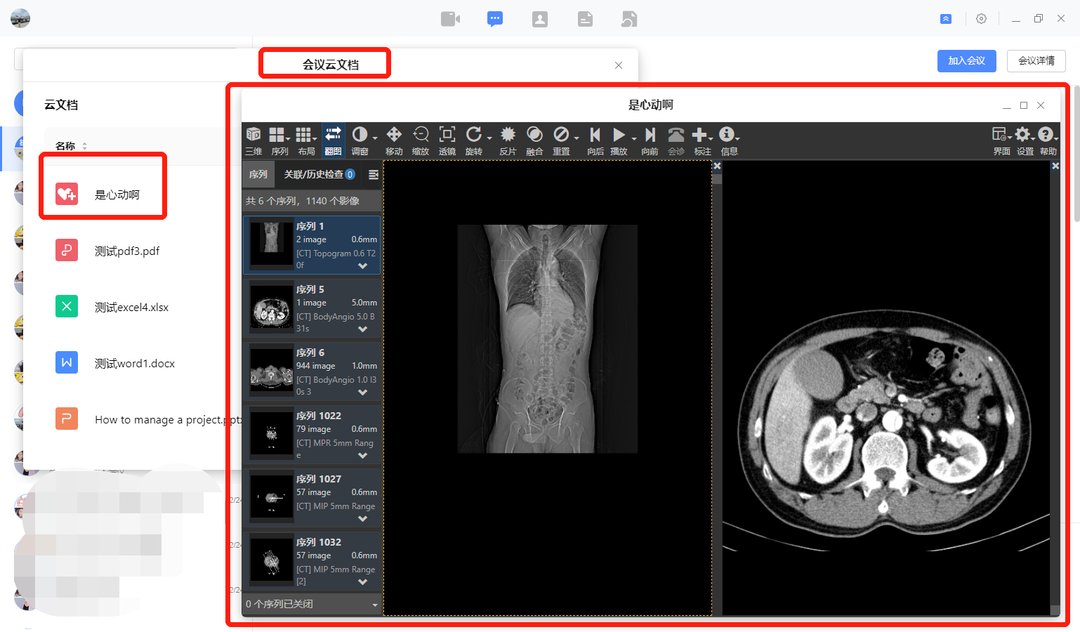 怎么用医学影像分析软件3D Slicer打开DICOM文件？ - 知乎
