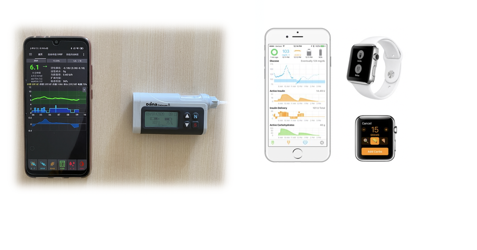 Loop和Android APS人工闭环大比拼 - 知乎