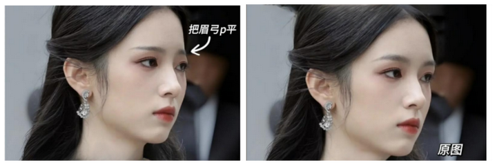 眉弓对颜值的影响有多大?什么人适合做眉弓?一般选什么材料合适? 知乎