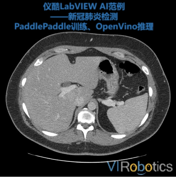 LabVIEW+OpenVINO在CPU上部署新冠肺炎检测模型实战 - 知乎
