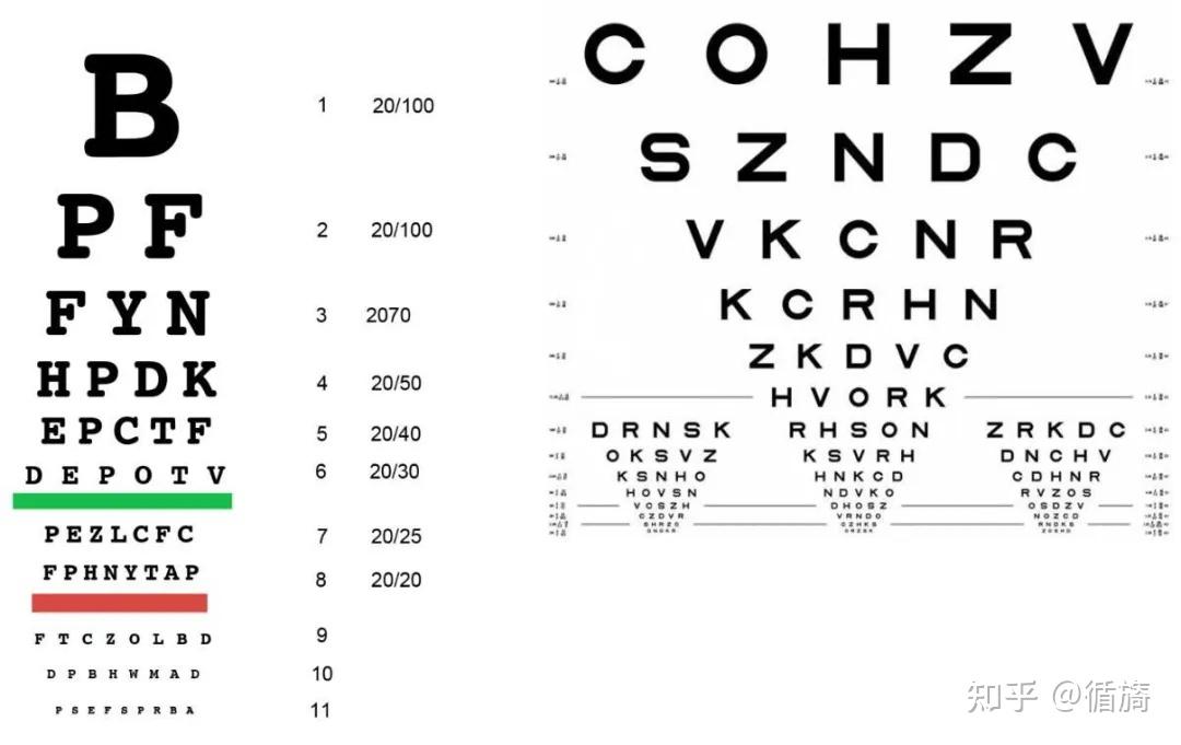 BEST1基因变异引起的黄斑营养不良征-卵黄蛋白病BVMD、AVMD、ARB、ADVIRC、RP - 知乎