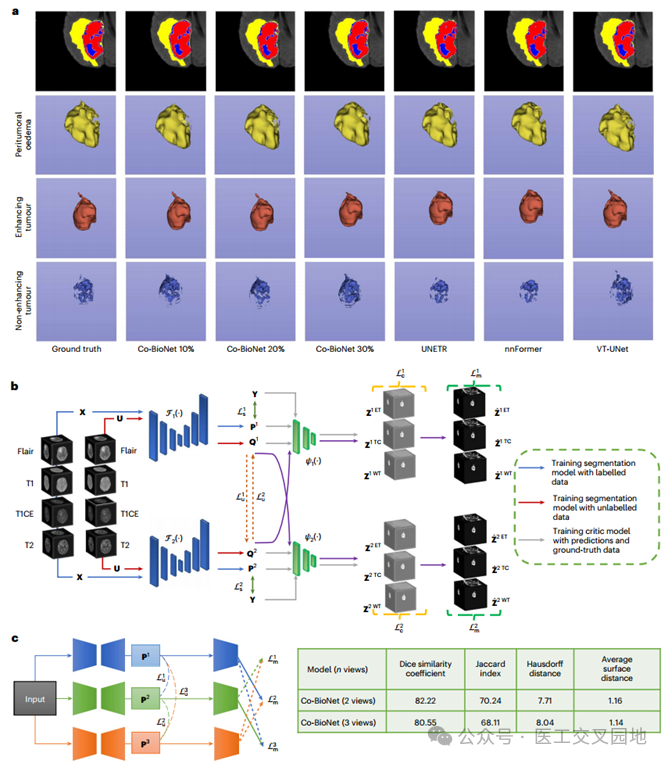澳大利亚蒙纳士大学的Himashi Peiris提出不确定性双视图导向的半监督医学图像分割算法 - 知乎