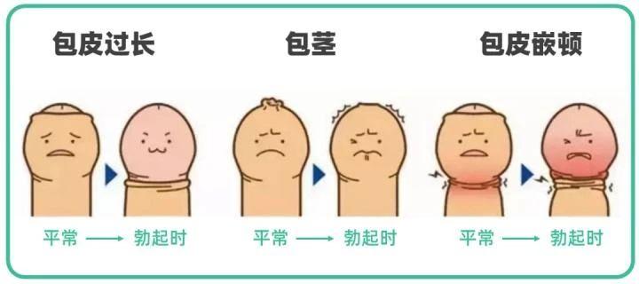 割过包皮的人都知道的事 知乎