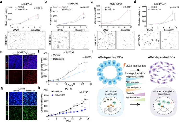 Cell Research 项目文章丨LKB1失活可促进前列腺癌表观遗传重塑诱导的谱系可塑性和抗雄激素耐药性 - 知乎
