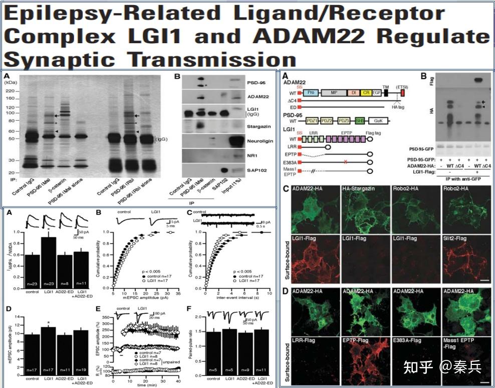 新版癫痫循证科普系列|| LGI1抗体脑炎 - 知乎