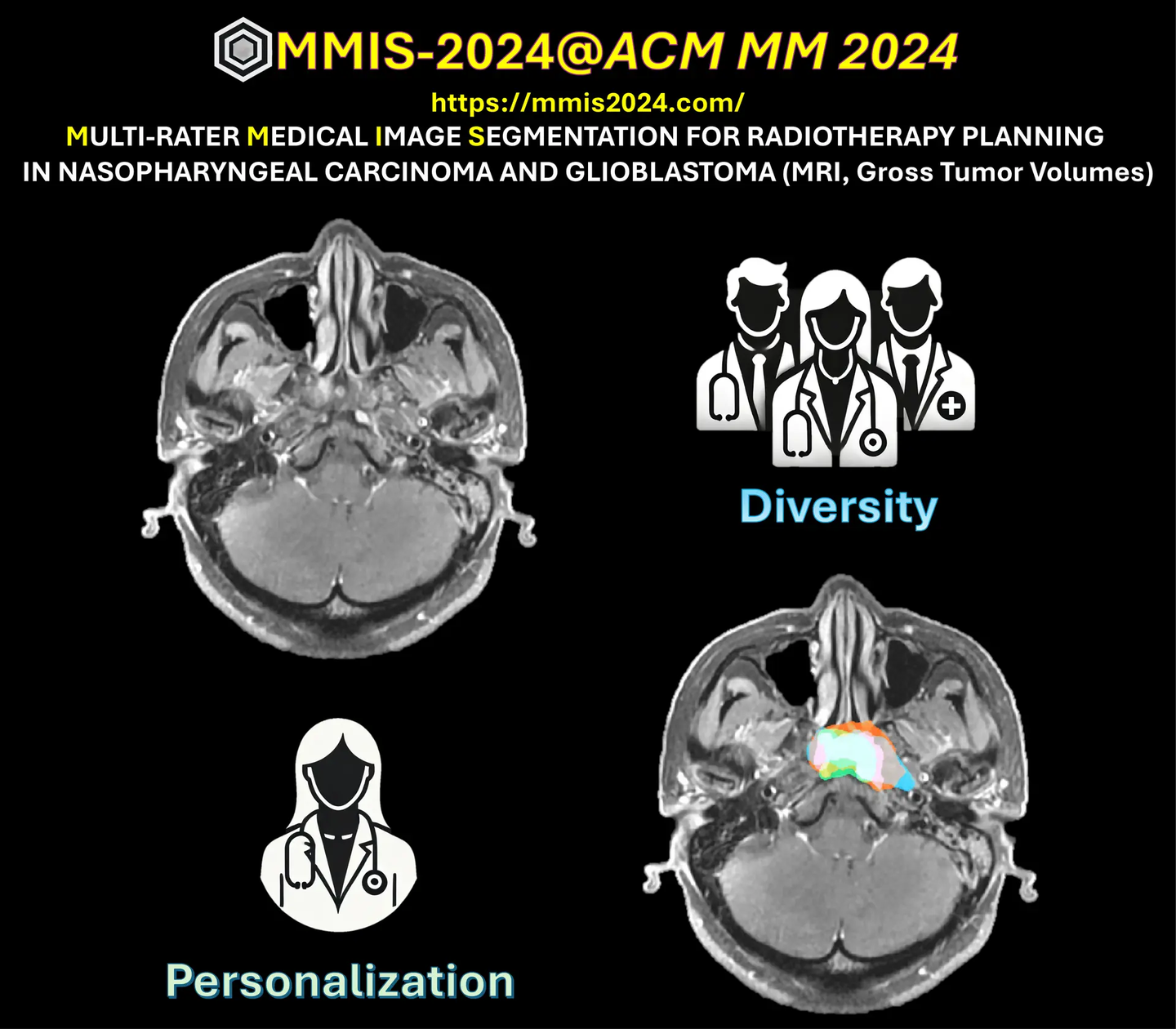MMIS-2024@ACM MM 2024 挑战赛数据集介绍 - 知乎
