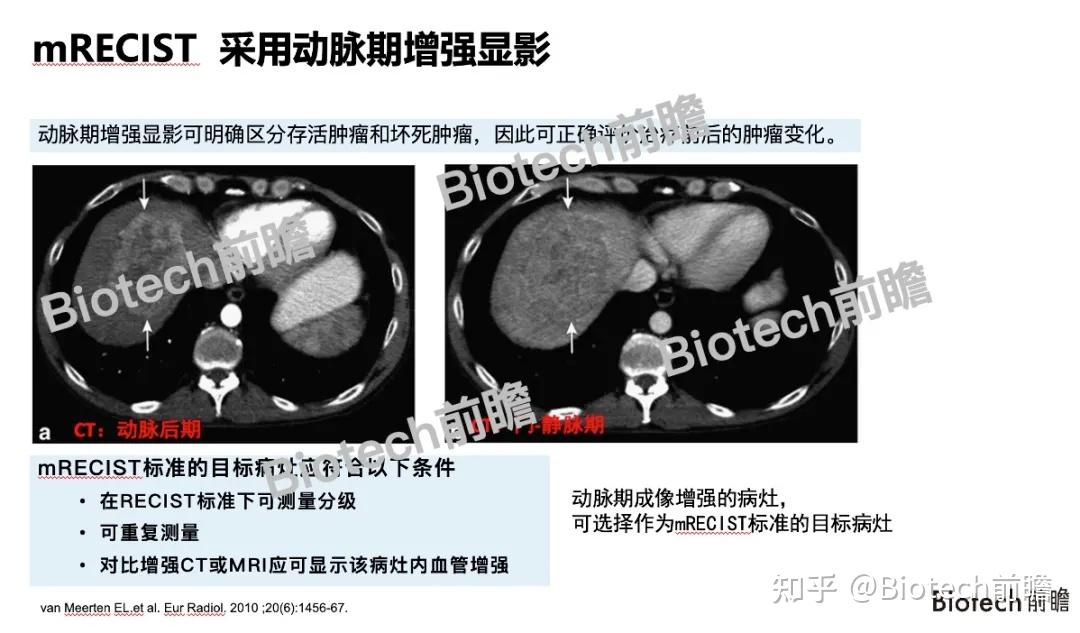 试验设计课堂丨读懂实体瘤疗效（RECIST1.1、mRECIST等）评估 - 知乎
