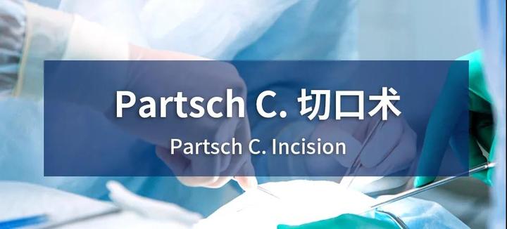 种植牙口外术式小百科—Partsch C. 切⼝術 - 知乎