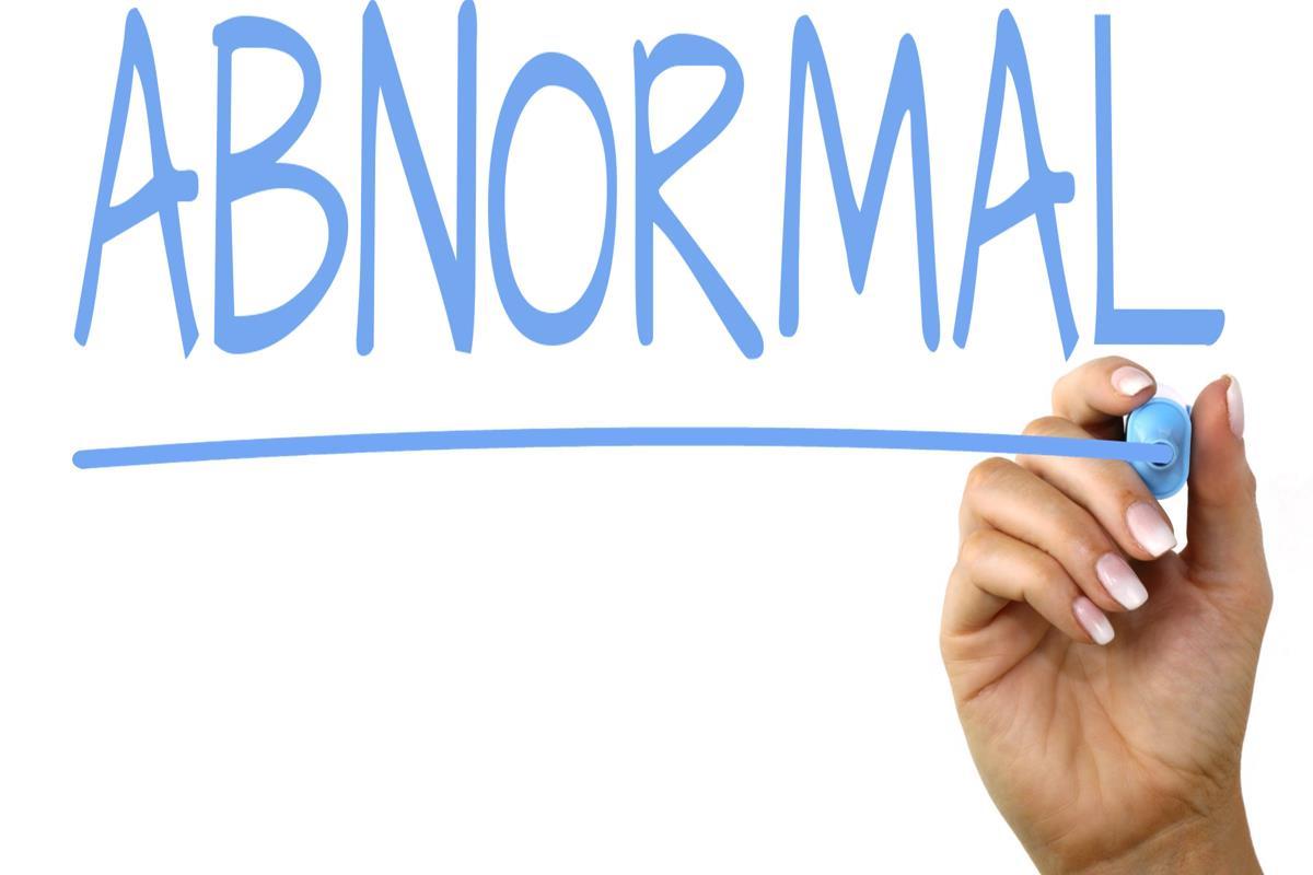 小词大义：abnormal 解析 - 知乎