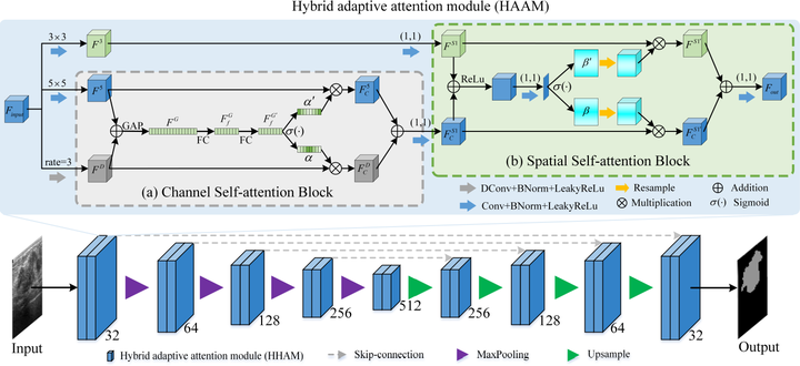 【TMI 2023】AAU-Net：一种用于超声图像中乳腺病变分割的适应性注意力U-Net（AAU-net） - 知乎