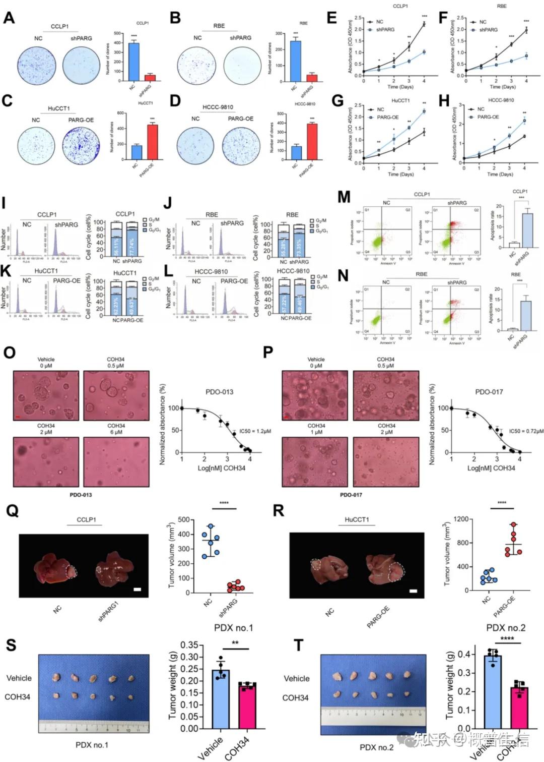 胆管癌治疗重大突破：靶向PARG调控Hippo，化疗、免疫双增效 - 知乎
