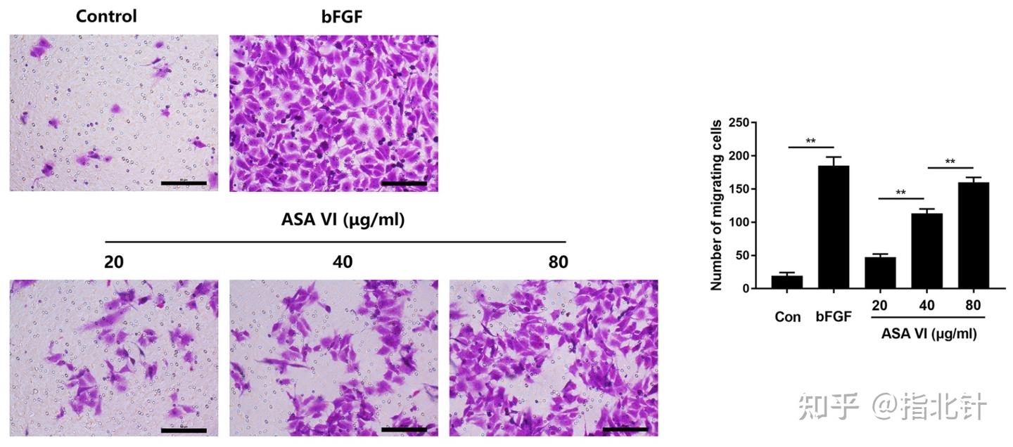 Transwell实验——原理、步骤、注意事项、示例图 - 知乎