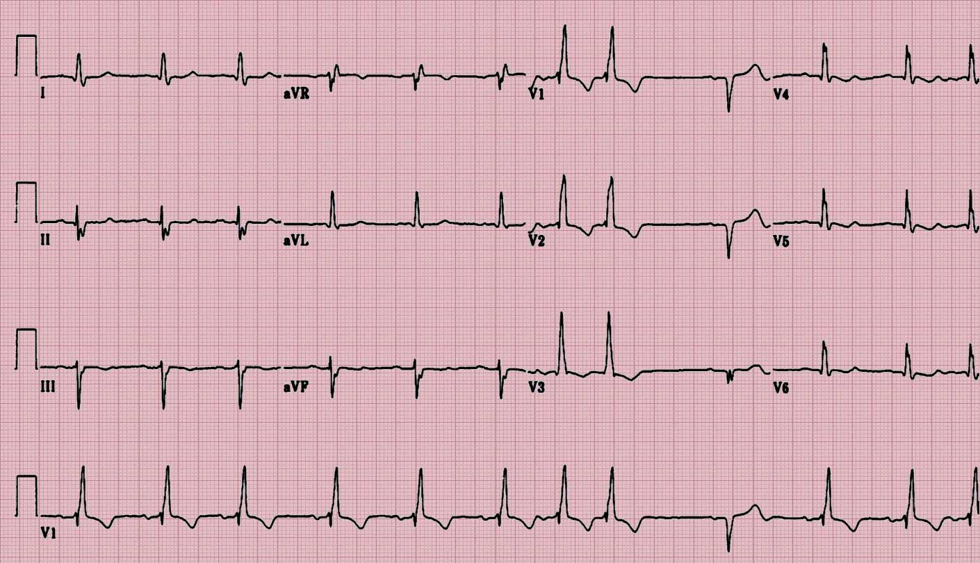 ECG心电图的智能手表和便携设备推荐（2021年最新） - 知乎
