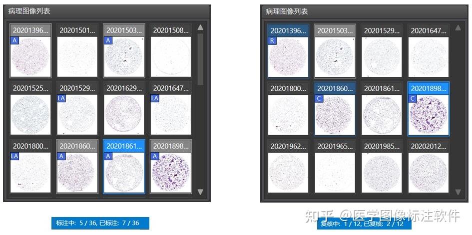 助力医学临床AI — MISAT医学图像分割与标注软件套装 - 知乎