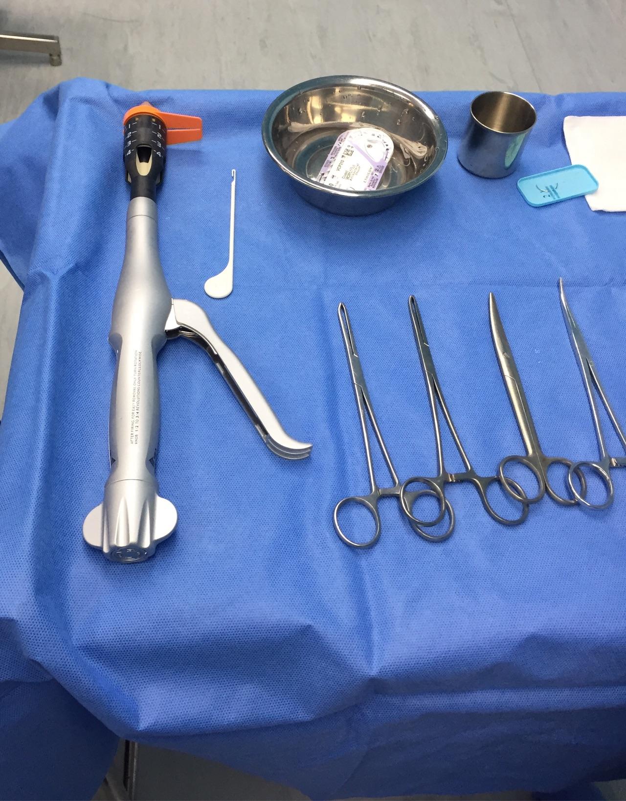 pph手术到底怎么样？ - 知乎