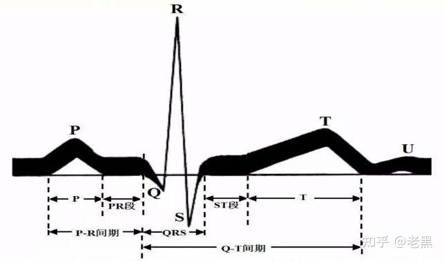如何读懂ECG心电图 - 知乎