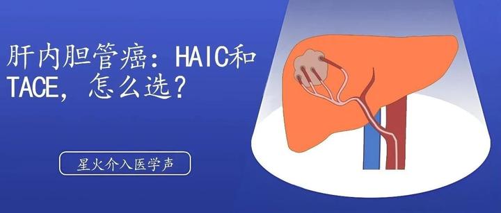 肝内胆管癌：HAIC和TACE，怎么选？ - 知乎