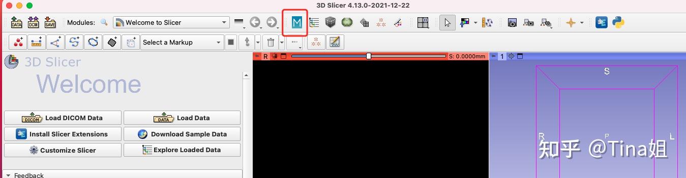 在3D slicer中使用MONAI Label 辅助标注提升标注速度-安装教程 - 知乎