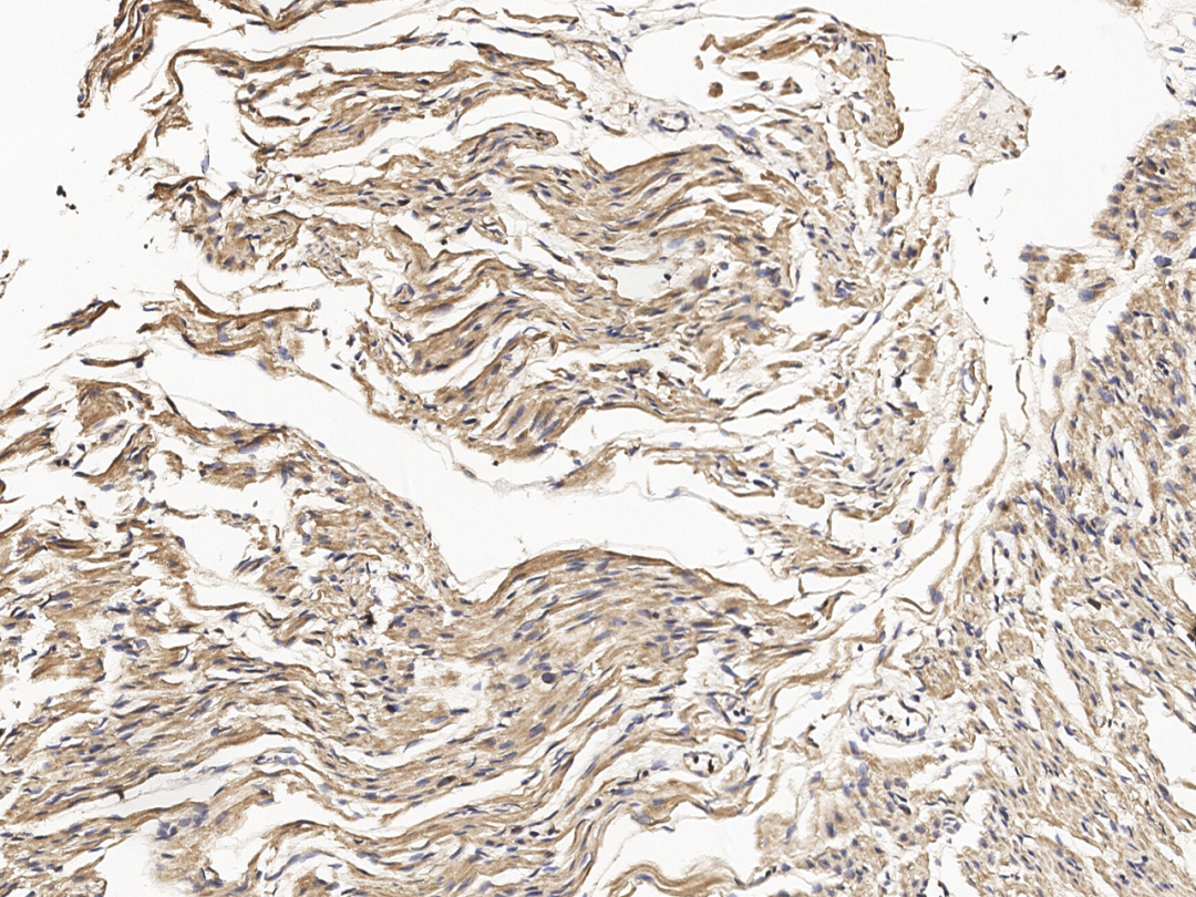 生物药为什么要检测残留的宿主细胞蛋白？ - 知乎