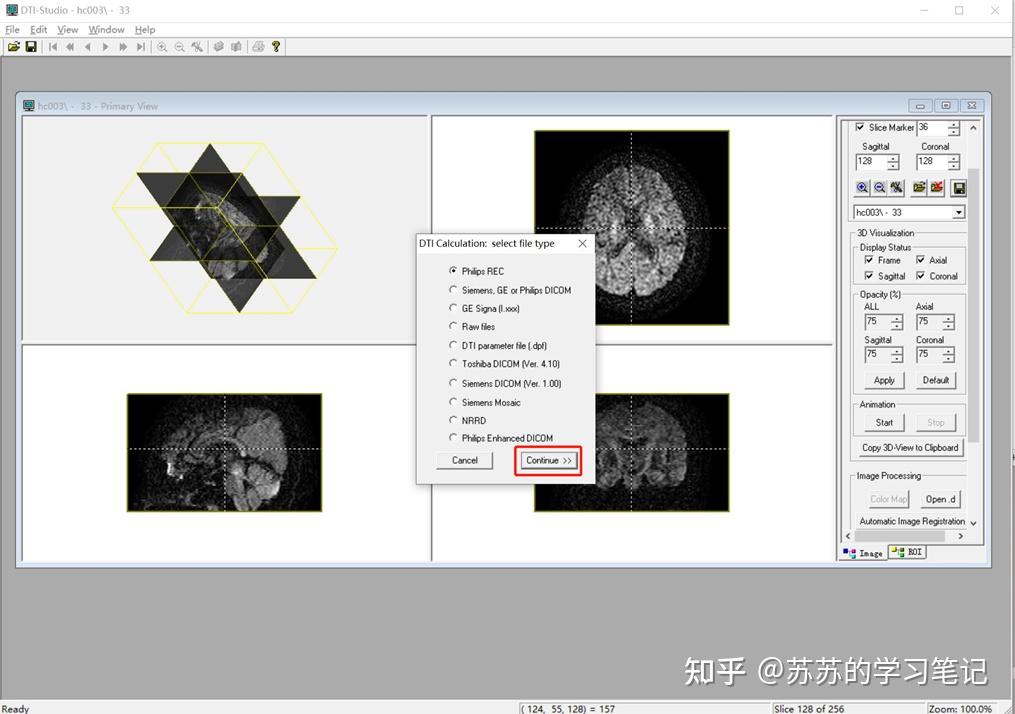 Diffusion spectrum imaging (DSI) 扩散光谱成像 与 Diffision tensor imaging （DTI ...