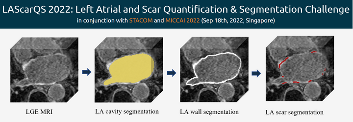 LAScarQS 2022 数据集介绍 - 知乎