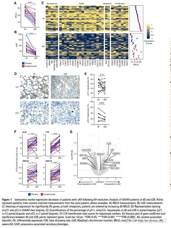 Gut（IF=23.1）|| 纵向配对肝活检和转录组分析揭示酒精相关性肝炎中细胞衰老的动态变化 - 知乎