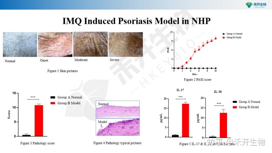 小禾说 | 自身免疫疾病靶点与模型系列(18)——IL-36R抗体：从皮肤到肠道呼吸道，适应症持续拓展 - 知乎