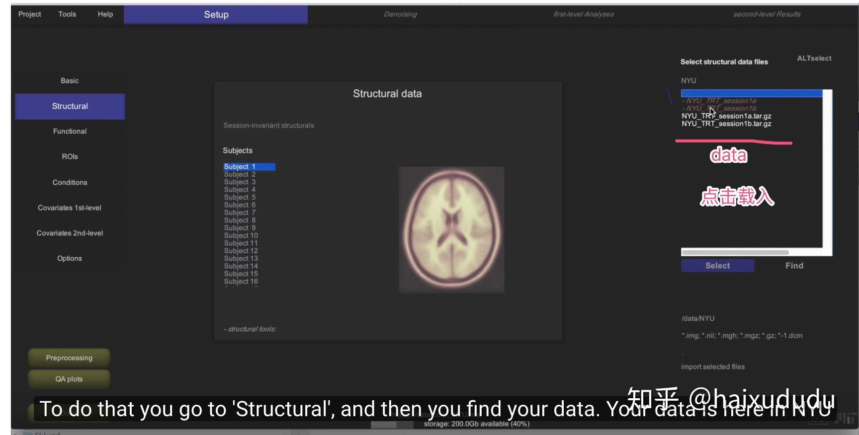 CONN使用总结1 (resting-state fMRI) - 知乎