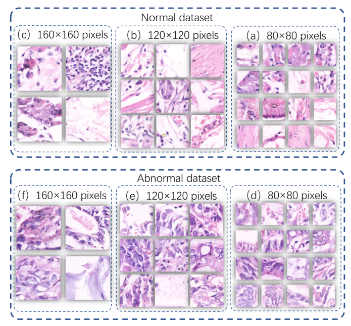 NuCLS 数据集介绍 - 知乎