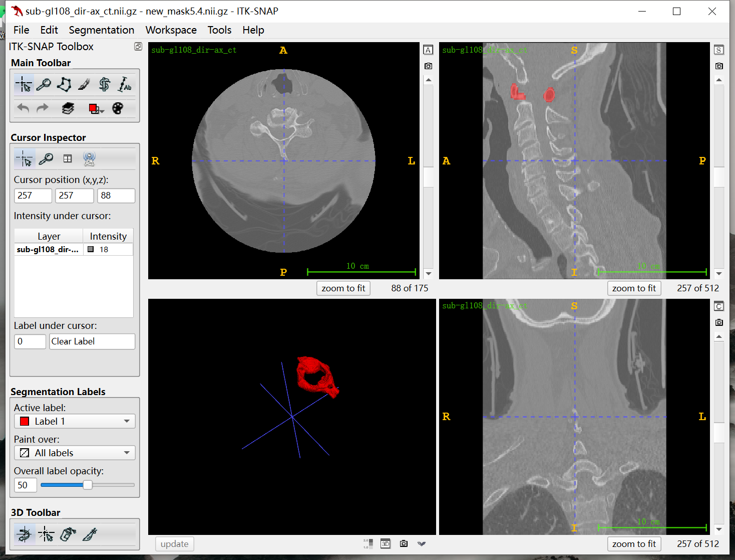 大佬们谁会nii图像文件的处理啊啊啊? - 知乎