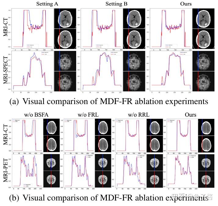 入选AAAI 2025！多模态医学图像融合新突破！ - 知乎