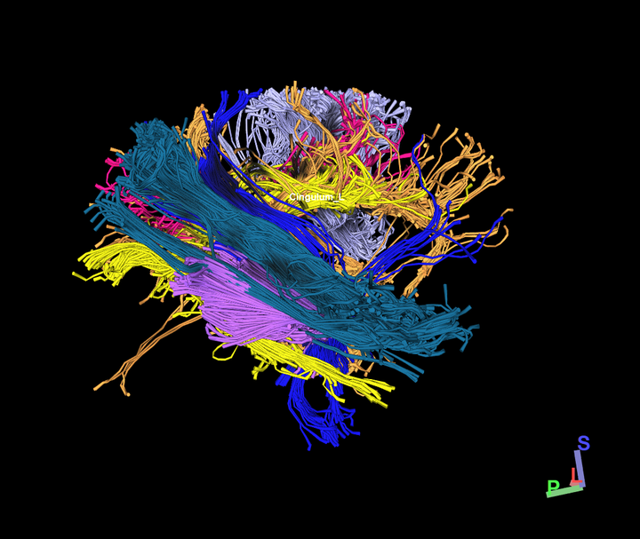 DTI的平台期已经出现 - 知乎