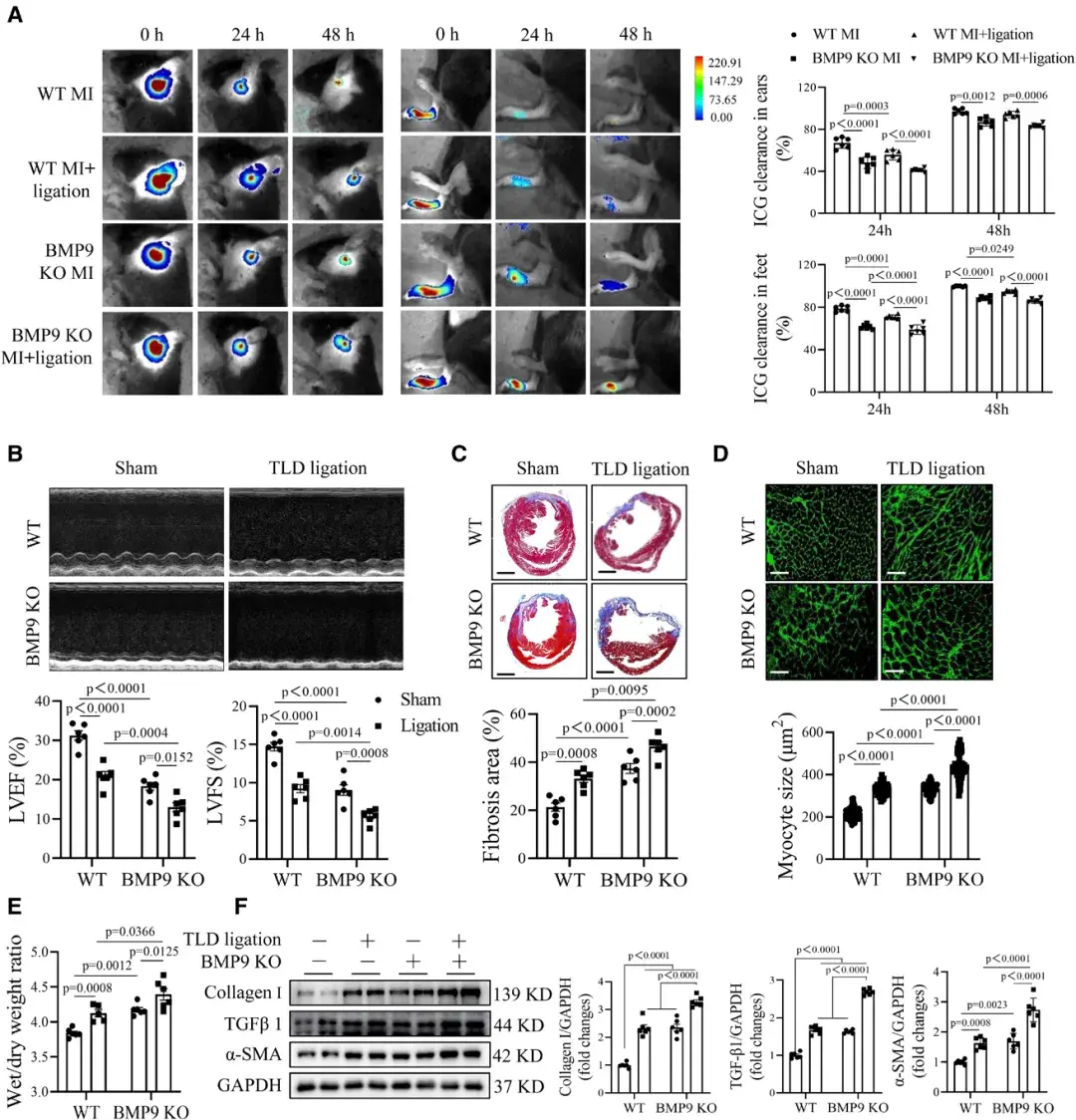 Circulation | 广东医科大学林灼锋团队蛋白组揭示BMP9心肌梗死保护机制 - 知乎