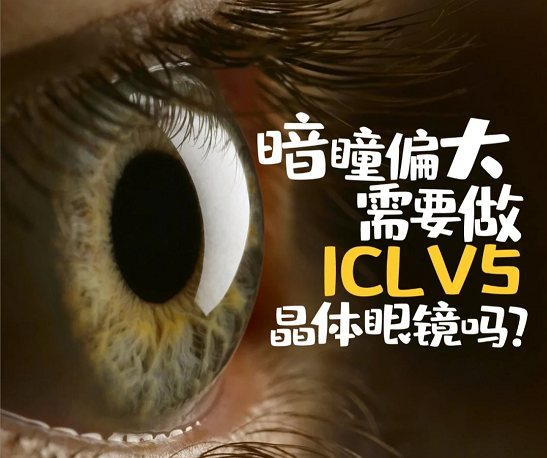暗瞳偏大 需要做ICL V5晶体植入吗？ - 知乎