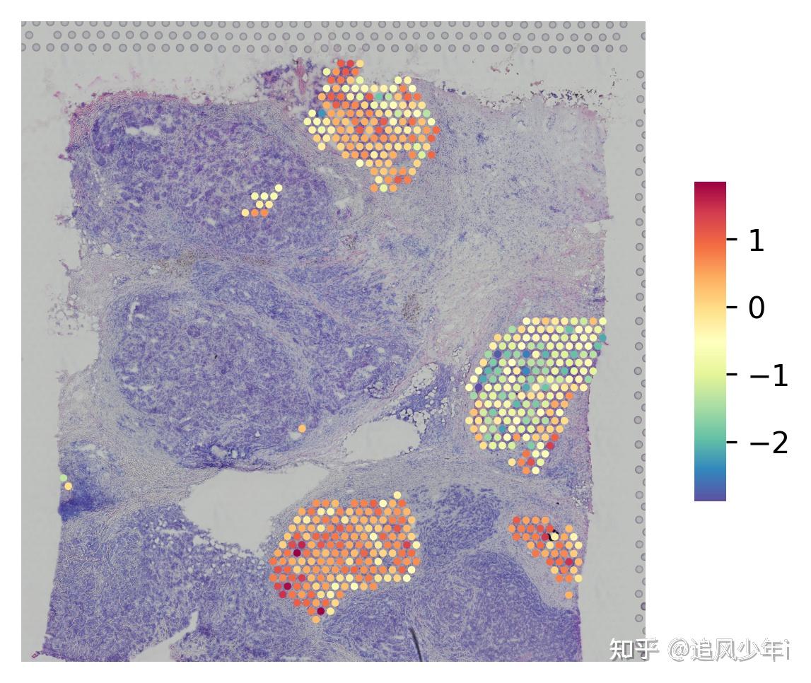 10X单细胞空间回顾之stlearn - 知乎