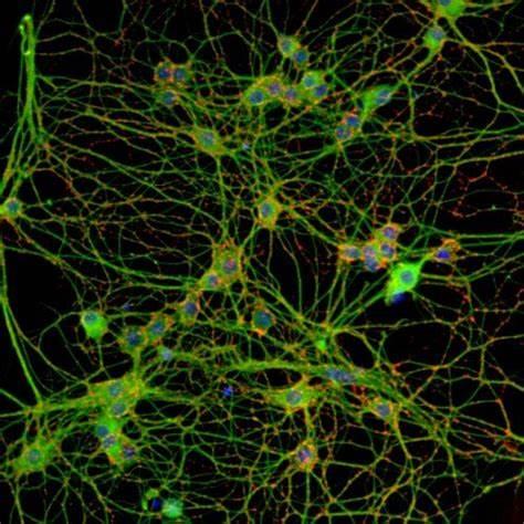 首创口服MRGPRX2拮抗剂：Escient 的EP262获FDA的IND许可，开展首次人体试验 - 知乎