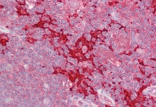 肿瘤免疫的“遥控器”，一起来看HPK1的最新研究进展 - 知乎