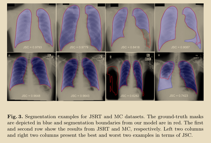 Accurate Lung Segmentation via Network-Wise Training of Convolutional Networks 阅读笔记 - 知乎