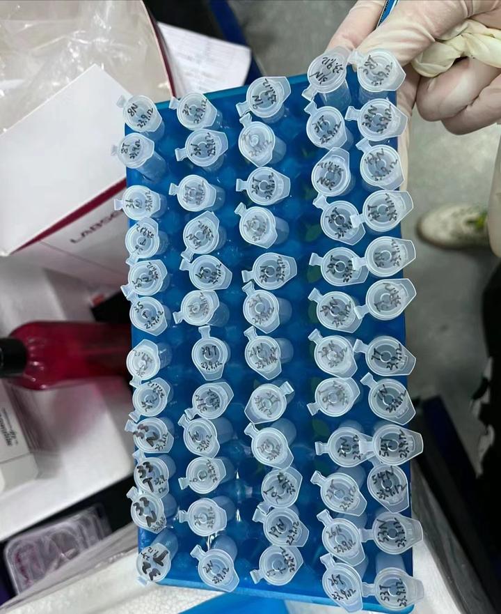 手把手教学——WB条带量化之ImageJ软件分析 - 知乎