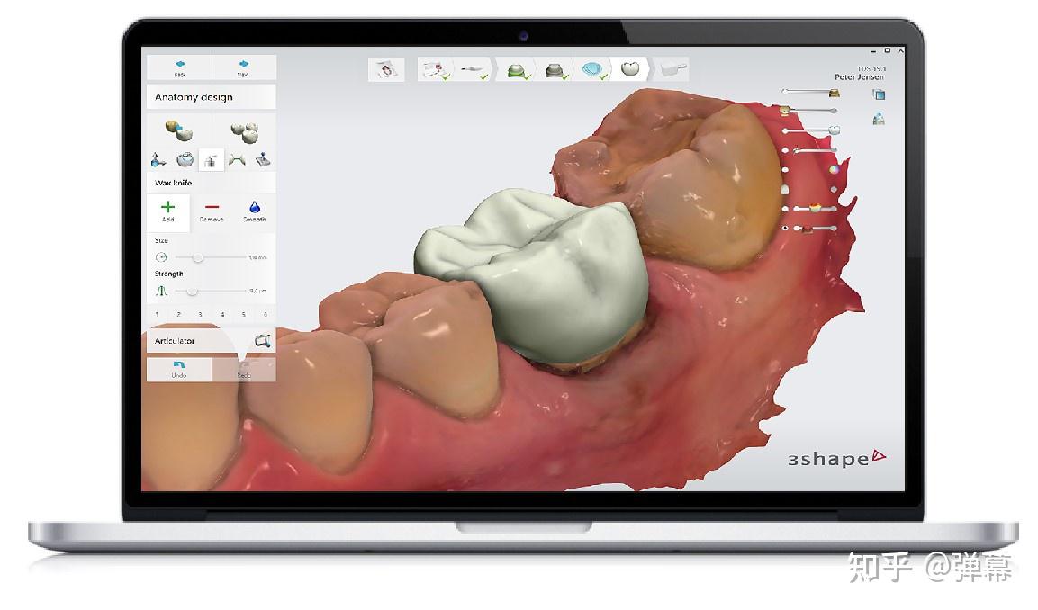 全新 3shape口扫 TRIOS 3 Basic - 知乎